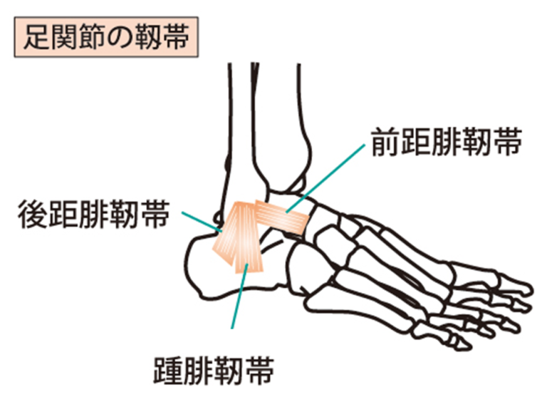 前距腓靱帯（anterior talofibular ligament：ATFL）損傷